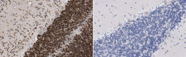 Anti-VGluT2 Antibody | AB2251-I